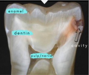 Dental Imaging: Advanced Technology for Accurate Diagnosis
